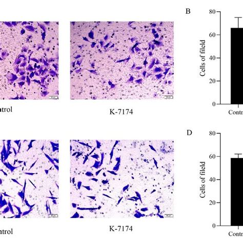 A And C Representative Images Of Transwell Assay For Invasion Using