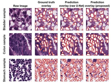 Examples Of Segmentation Results Download Scientific Diagram
