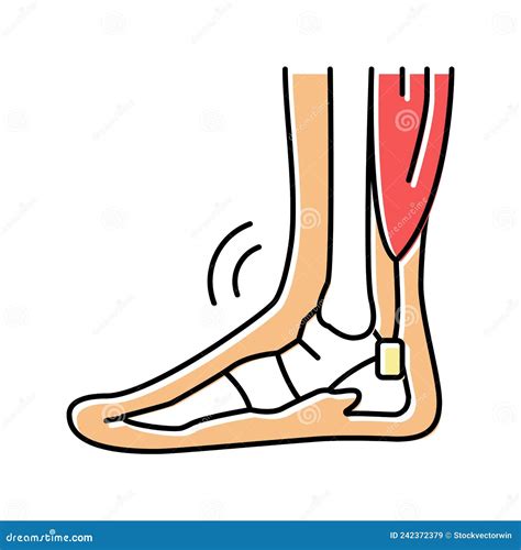 Tendonitis Problem Color Icon Vector Illustration Stock Vector
