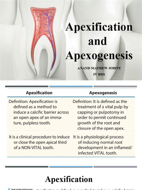Apexification And Apexogenesis Pdf Medical Specialties Tooth