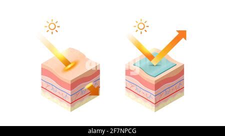 Uv Ray From Sun Penetrate Into Epidermis Of Skin Cross Section Of Human