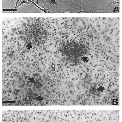 A Phase Contrast Photomicrographs Of Day 1 Untreated Cul Download