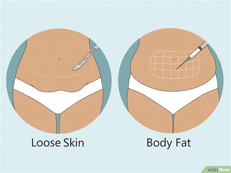 How To Tell The Difference Between Fat And Loose Skin