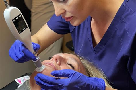 The Future Of Plasma Is Jet Pro Plasma Esthetic