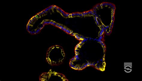 Hematoxylin And Hematein Dyes For Histology Stainsfile