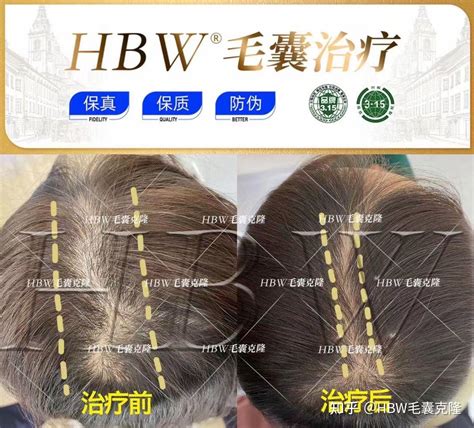 Hbw