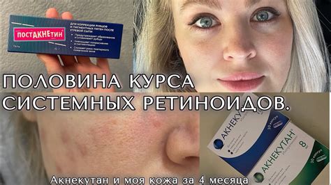 ПОЛОВИНА КУРСА НА РЕТИНОИДАХ Мое до после Делюсь самочувствием и