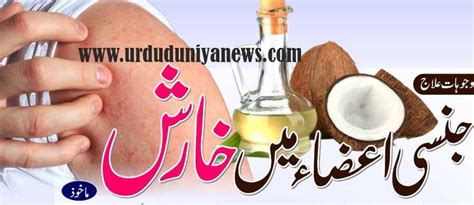 وجوہات علاج جنسی اعضاء میں خارش Urduduniya News اردو دنیا نیوز