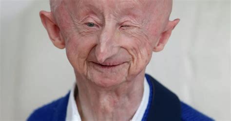 Alan Barnes Fund Messages Of Support Flood In Chronicle Live