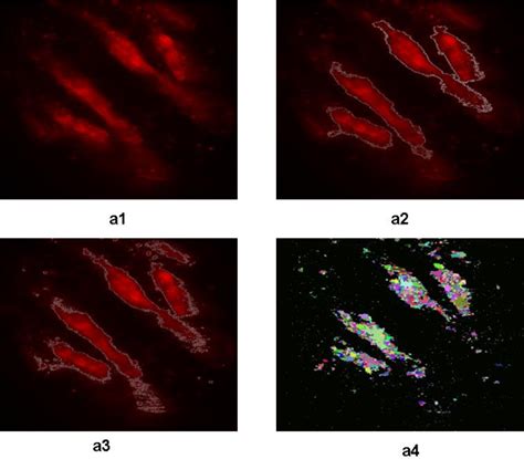 figure 4 from an enhancement neighborhood connected segmentation for 2d