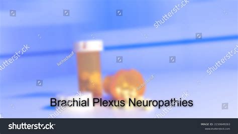 Brachial Plexus Netter