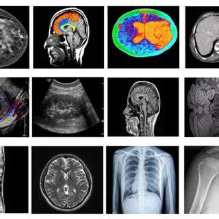 Compression Encryption Algorithm Download Scientific Diagram
