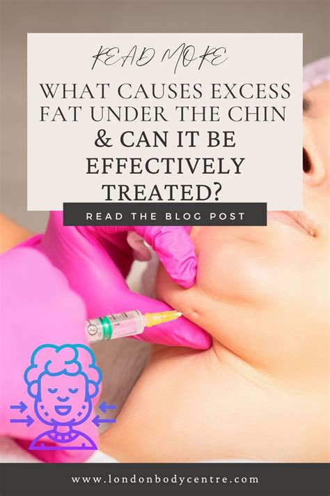 Unmasking The Double Chin Causes And Effective Treatments