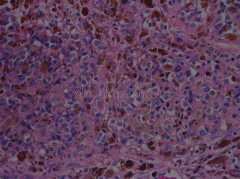 Histopathology Of Skin Stained With Hande Stock Image Image Of Purple