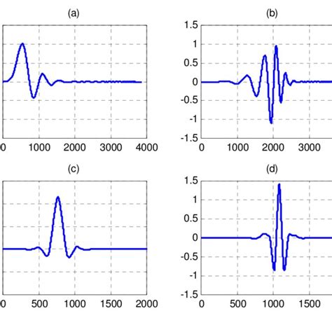 pdf a wavelet packets based algorithm for eeg signal compression