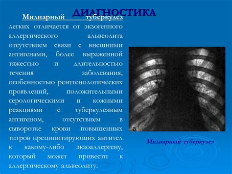 Презентация Экзогенный аллергический альвеолит по медицине скачать