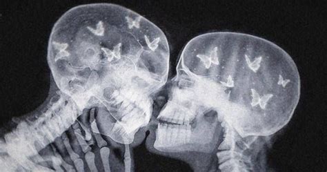 X Ray Aesthetic Wallpaper Aesthetic Wallpapers Skeleton Love