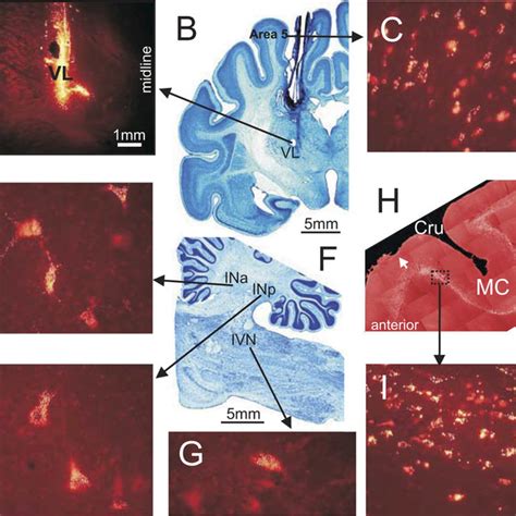 Axonal Conduction Velocities Of Thalamo Cortical Projection Neurons