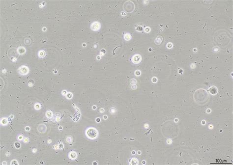 135 Questions With Answers In Epithelial Cell Culture Science Topic