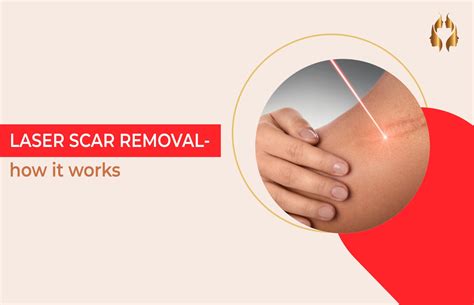 Laser Scar Removal In Chennai Raj Cosmeticsurgery