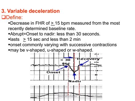 Ctg Patterns Pdf