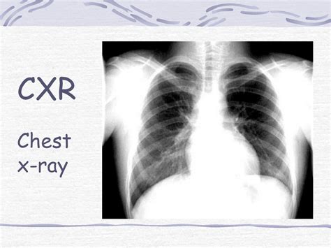 Medical Terminology Abbreviations Lesson Ppt Download