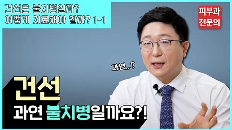 건선 불치병이라고ㅣ건선 치료방법 소개 Youtube