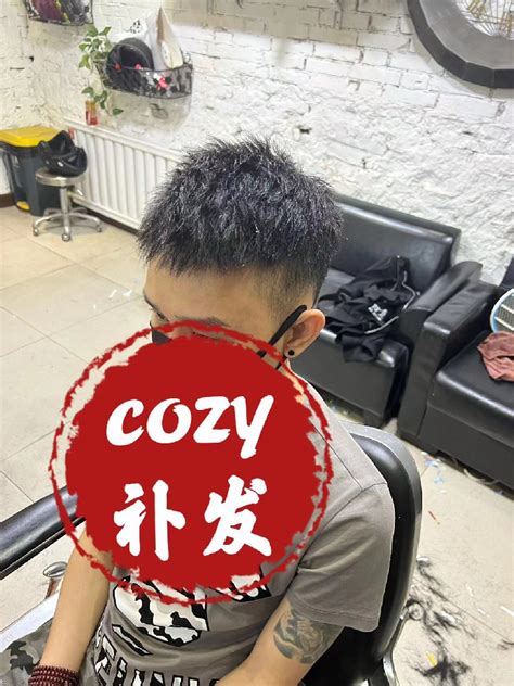补发案例 沈阳盛源cozy织发补发假发定制中心 沈阳假发补发织发定制服务专业店！