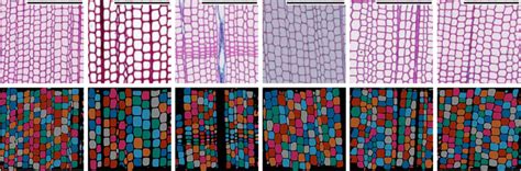 Best Results Of The U Net Based Segmentation According To The Panoptic