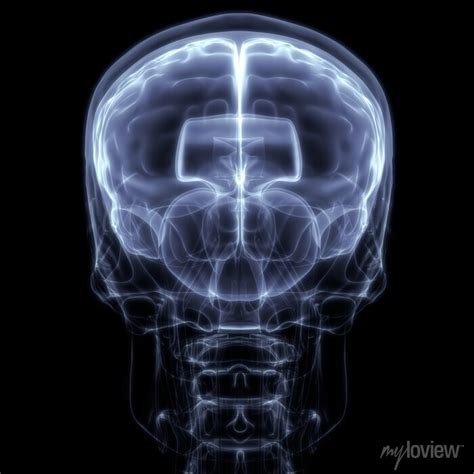 Human Internal Organ Brain With Nervous System Anatomy X Ray • Wall