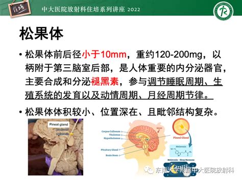 PPT松果体区占位性病变的诊断思路 影像PPT