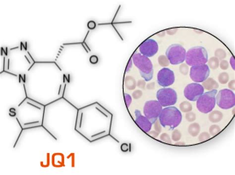 Insights Into Drug Resistance For A Rare Leukemia Broad Institute