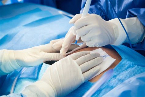 Cesarean Section Delivery And Associated Birth Injuries