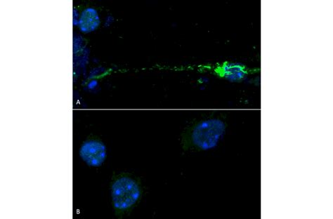 Anti Alpha Synuclein Phospho Ser129 Antibody A305044