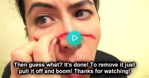 Dont Forget To Eat Your Scars  On Imgur