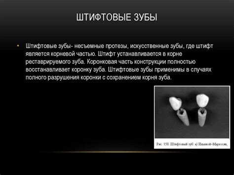 Изготовление штифтовых конструкций в ортопедической стоматологии ...