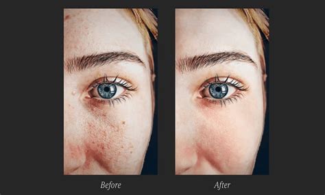 Do Photoshop Editing Photo Manipulation Remove Object By Cenkss Fiverr