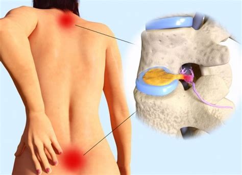 How Does Osteopathy Work Osteopath Sutherland Shire