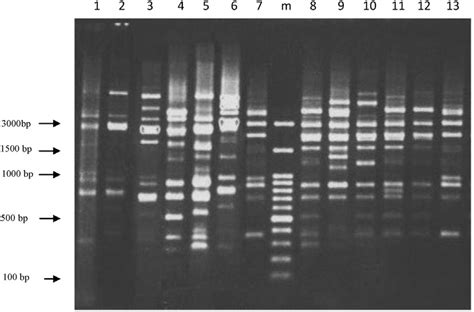 Repetitive Extragenic Palindromic Rep Pcr Patterns Of Genomic Dna