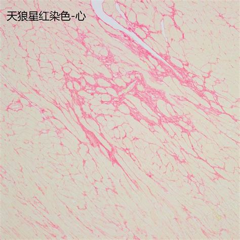 天狼猩红染色服务