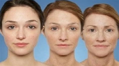 악건성 예민성과민성민감성 피부의 발생 원인1세르망 피부정보 네이버 블로그