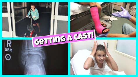 Gabrielles Broken Leg Getting A Cast Youtube