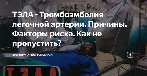 ТЭЛА Тромбоэмболия легочной артерии Причины Факторы риска Как не