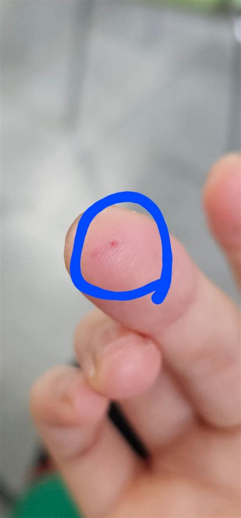 손가락에 빨간색 뭘까요 지식in