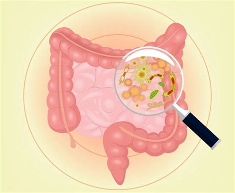 RENOVAÇÃO VOCÊ VAI SE SURPREENDER O QUE VAI SAIR DO SEU INTESTINO