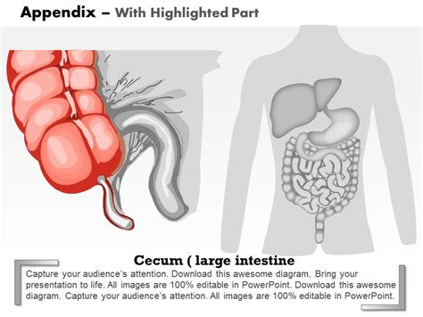 Appendix Medical Images For PowerPoint Template Presentation Sample Of PPT Presentation