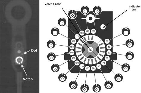 Codman Programmable Shunt Brain