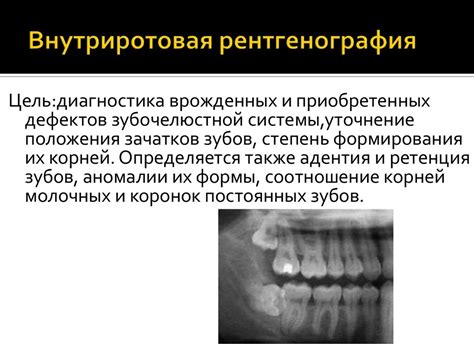 Телерентгенография - презентация онлайн