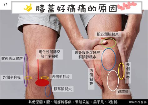 膝蓋痛的原因是什麼？堡醫師教你 怎麼自己當醫生！ 台北原力復健科診所 侯鐘堡醫師