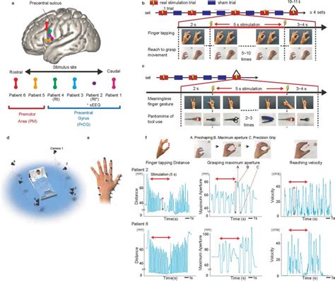 Functional Brain Mapping Togo Et Al Precentral Negative Motor Area